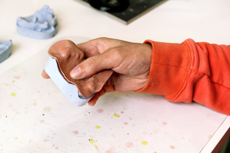 Working with Shellac Base Plates Over the Plaster Model Stock Photo ...