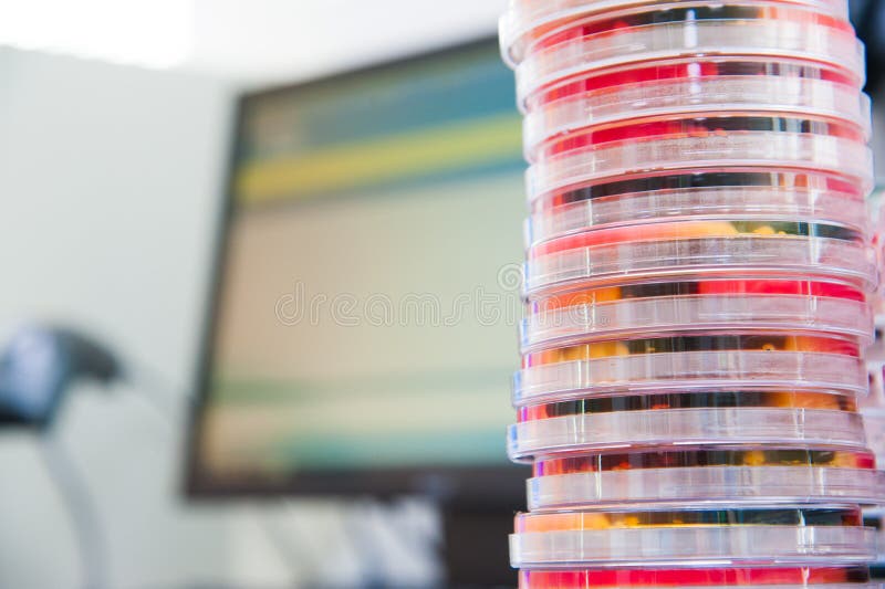 Microbiology Research in Laboratory Stock Photo - Image of biology ...