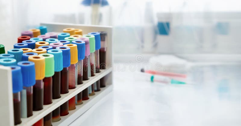 Workplace Rack with Tubes of Blood Samples from Patients in the ...