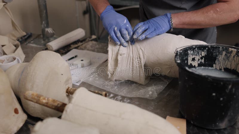 Prosthetic Innovations, Workspace Construction, Plaster Crafting Stock ...