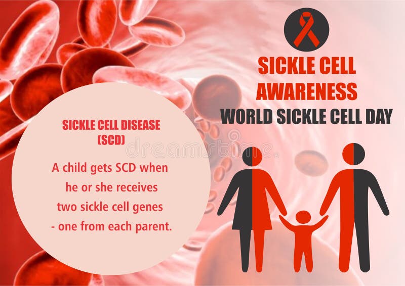World Sickle Cell Day Concept Vector. Sickle Cell Disease, SCD is a ...