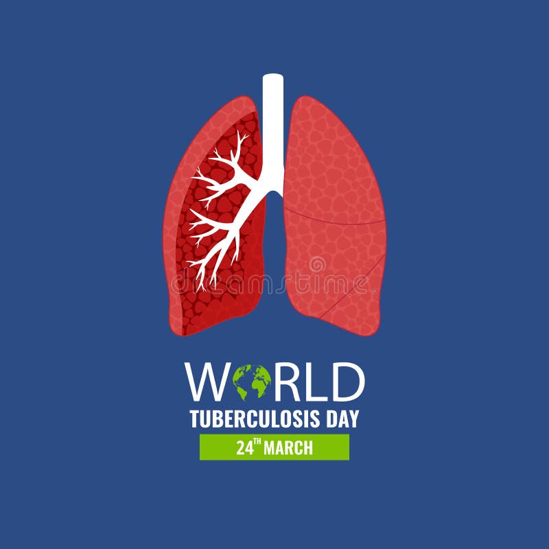 World Tuberculosis Day stock illustration. Illustration of condition ...