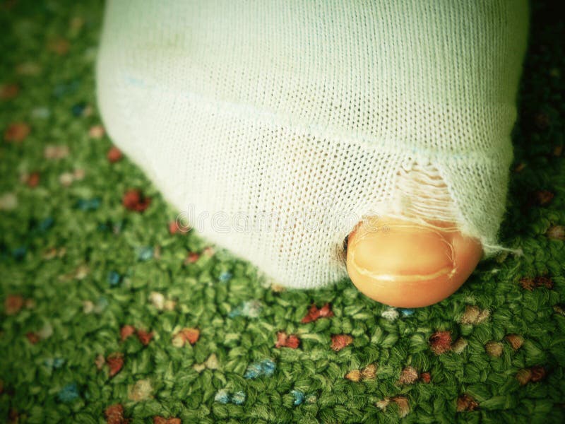 Worn out socks. stock photo. Image of lifestyle, body - 55295378