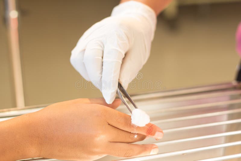 Wound care with suture stock image. Image of hospital - 61814561