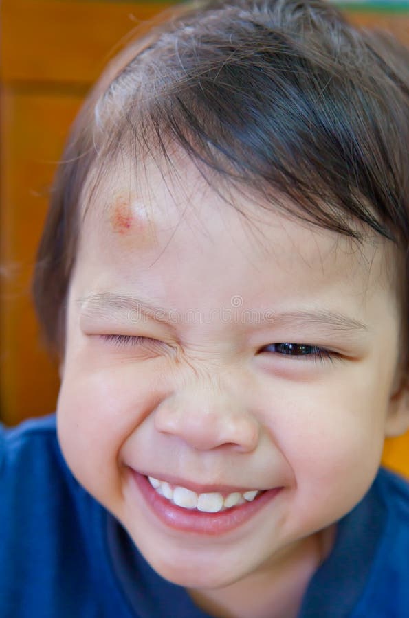 Wound child stock image. Image of little, caucasian, body - 36249247