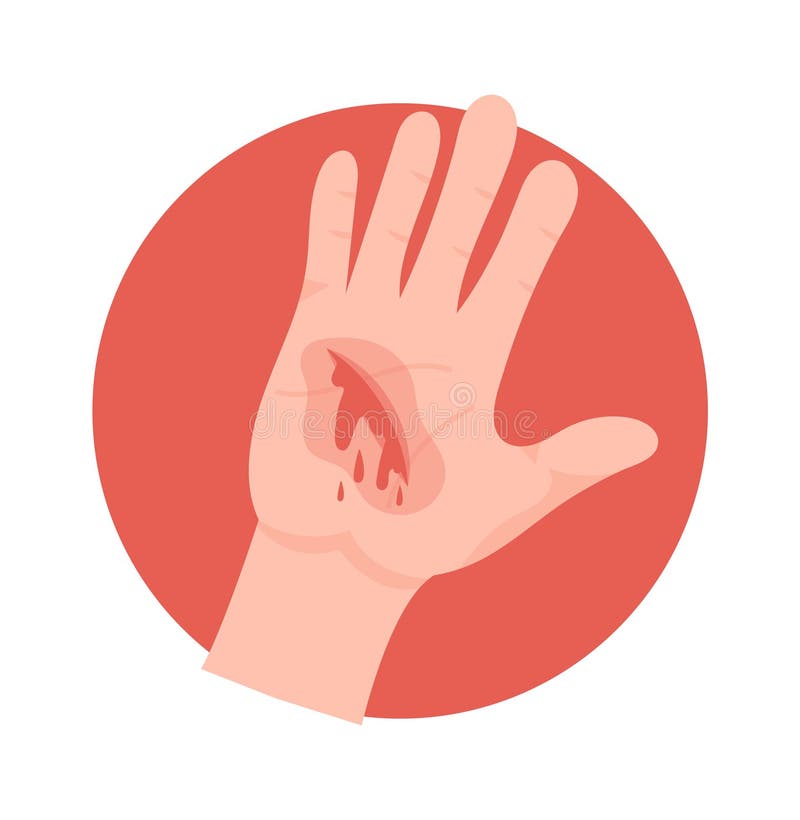 Wound Continues To Bleed stock vector. Illustration of licking - 277675721