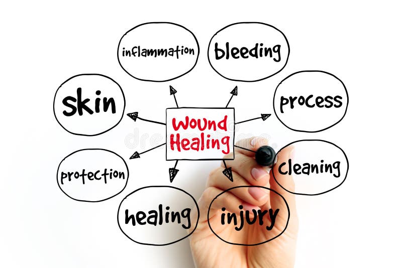 Wound Healing Mind Map, Health Concept for Presentations and Reports ...