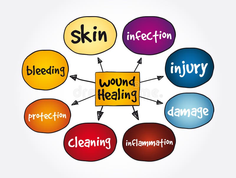 Wound Healing Mind Map, Health Concept for Presentations and Reports ...