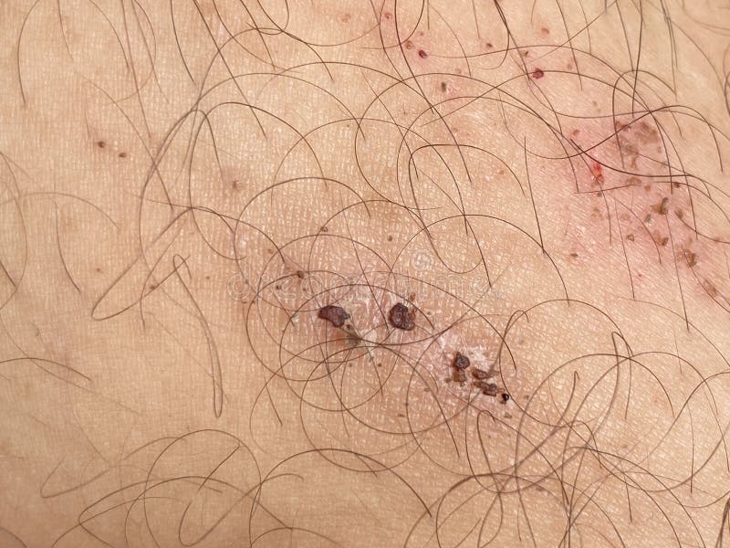 3,681 Wound Texture Photos - Free & Royalty-Free Stock Photos from ...