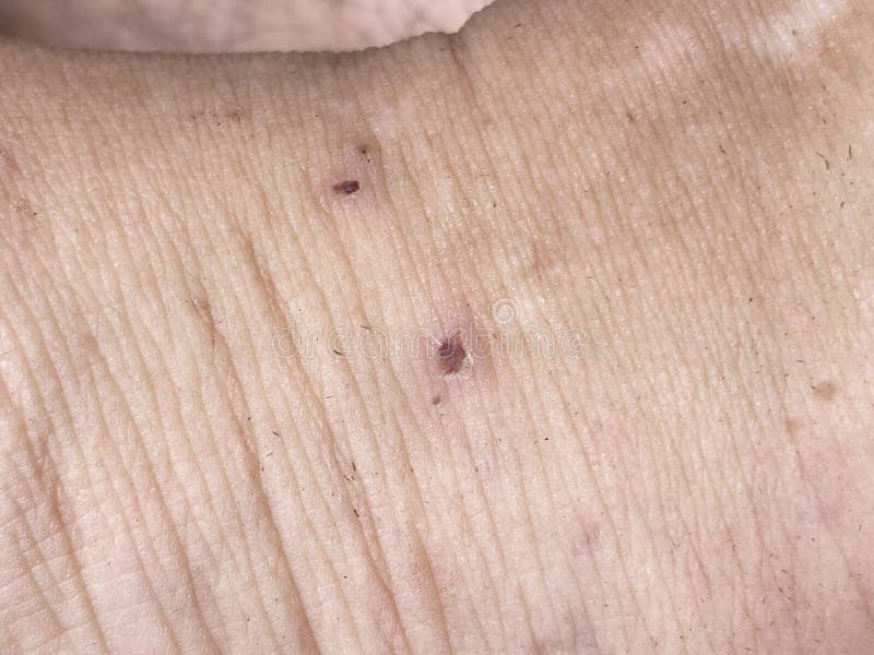 Wound on skin leg stock image. Image of sick, wound - 253695759