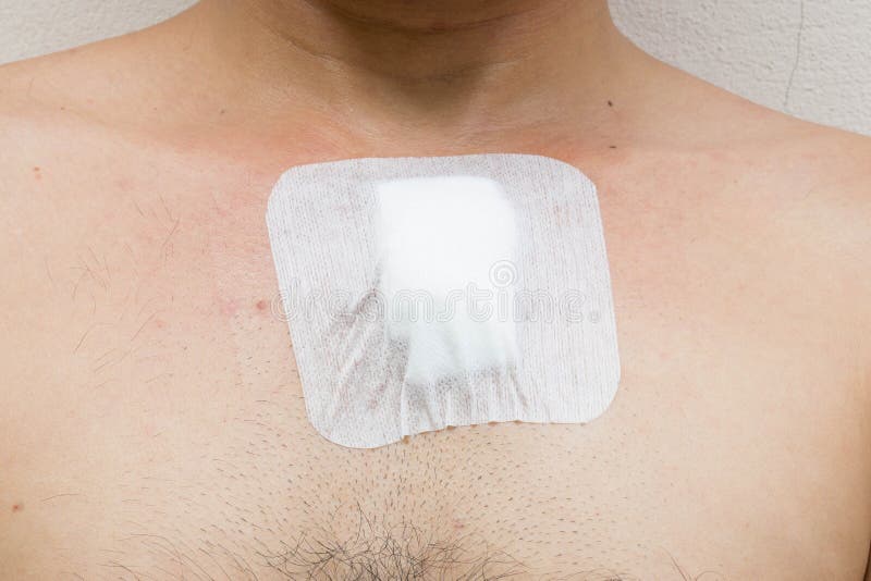 205 Chest Wound Stock Photos - Free & Royalty-Free Stock Photos from ...