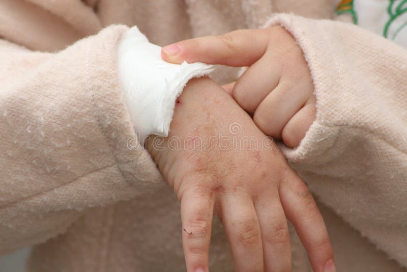 Wounded hand stock image. Image of wounded, wound, playground - 2338955