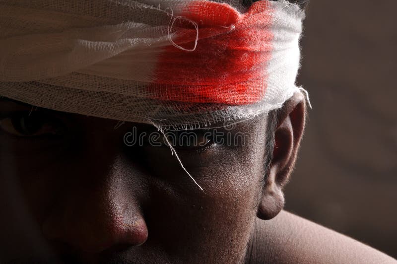 Wounded person stock image. Image of heal, body, health - 10557537