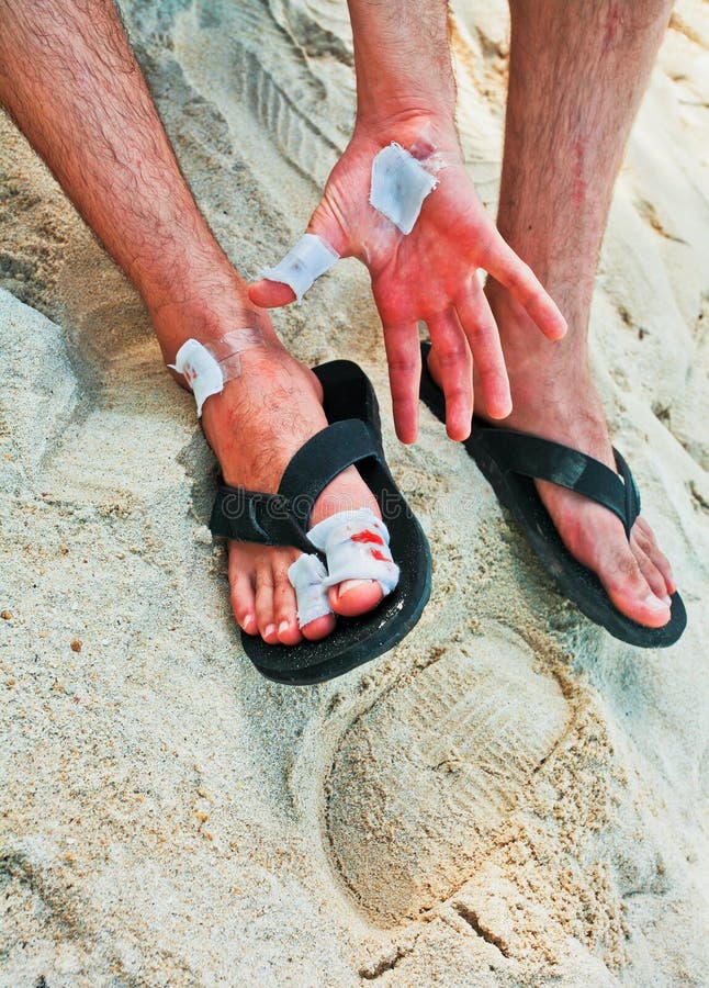 Wounding of feet and hand stock photo. Image of emergency - 66490840