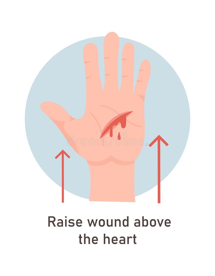 Wounds First Aid stock vector. Illustration of care - 277675827