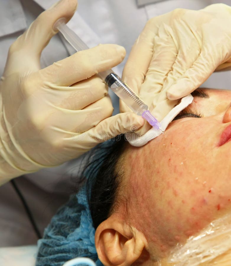 Wrinkle Treatment Injecting Stock Photo - Image of head, face: 58482974