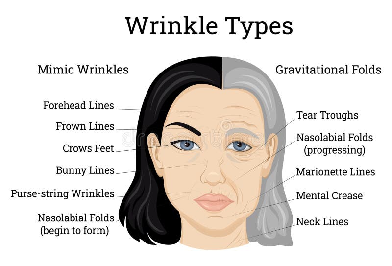 Wrinkle Types Illustration stock vector. Illustration of neck - 177846443