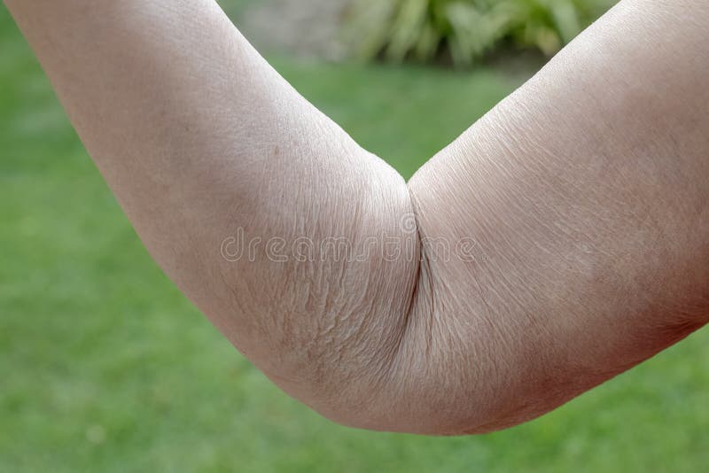 Wrinkled woman skin stock image. Image of plastic, textured - 22149113