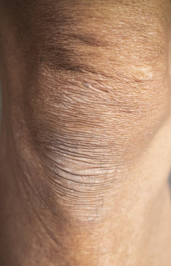 Wrinkles Rough Skin Knees Stock Photos - Free & Royalty-Free Stock ...