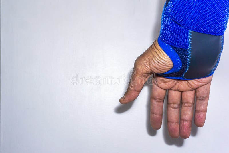 Wrist Brace for Twisted Hand Stock Photo - Image of orthopedic, health ...