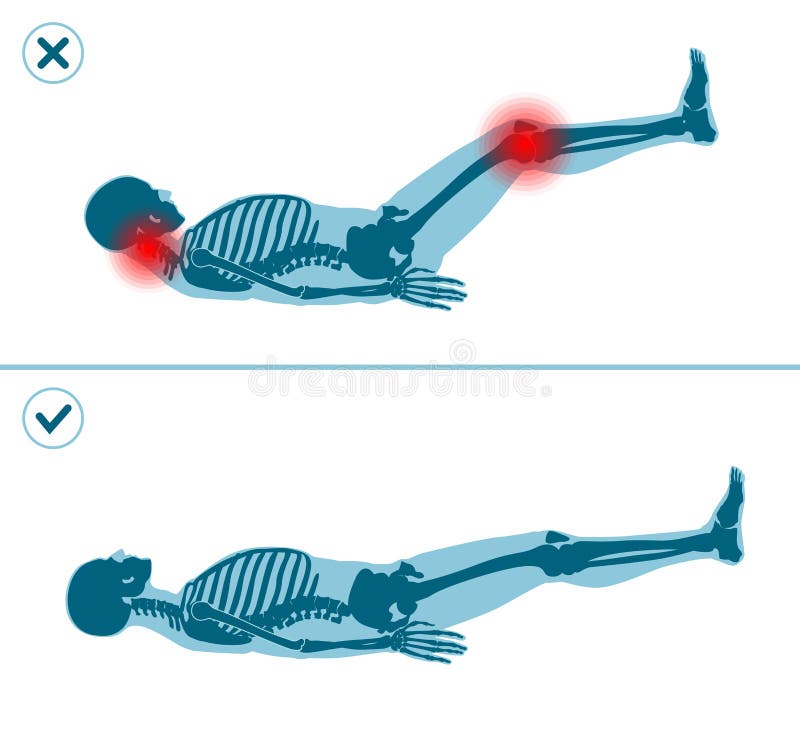 Wrong and Correct Plank Position. Right and Wrong Execution Technique ... Wrong and Correct Plank Position. Right and Wrong Execution Technique ...