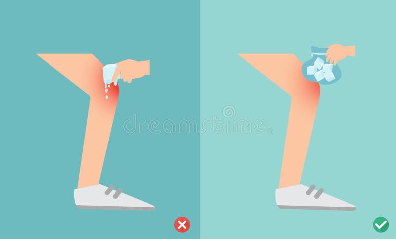 Wrong and Right Ways First Aid of Using Cold Packs for Injury Stock ...