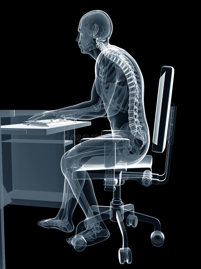 Wrong sitting posture stock illustration. Illustration of improper ...
