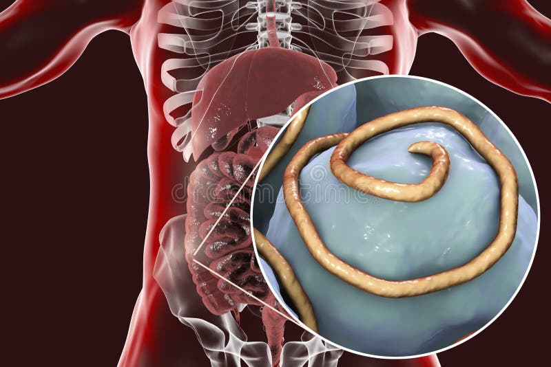 Bandwurmplage In Einem Menschlichen Darm Stock Abbildung - Illustration ...