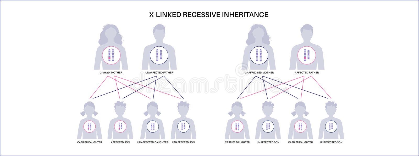 X Linked Inheritance Stock Illustrations – 37 X Linked Inheritance ...