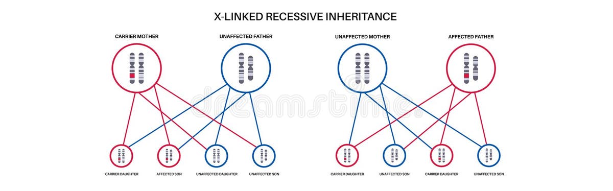 X Linked Inheritance Stock Illustrations – 51 X Linked Inheritance ...