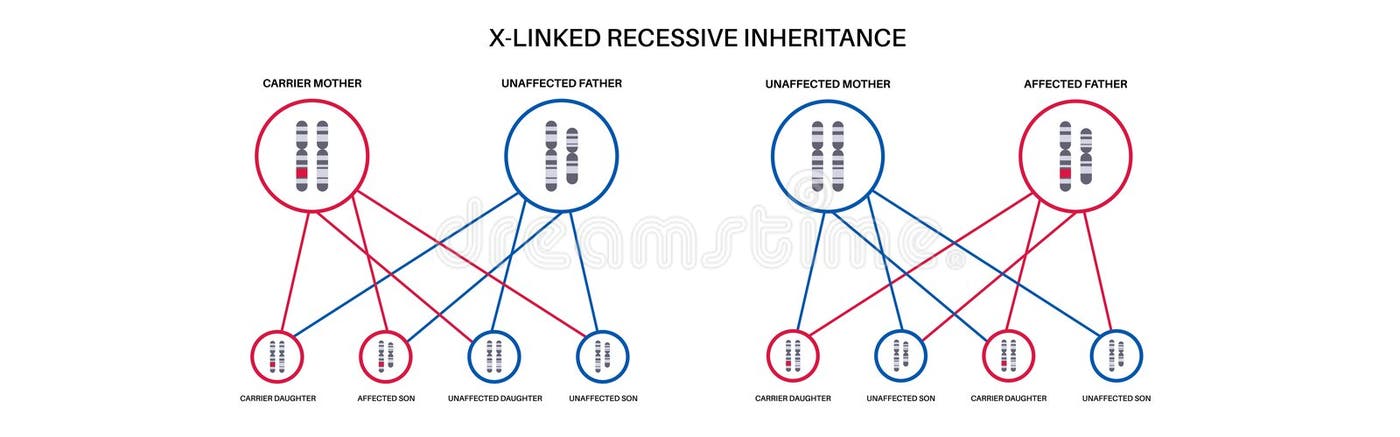 X Linked Inheritance Stock Illustrations – 51 X Linked Inheritance ...