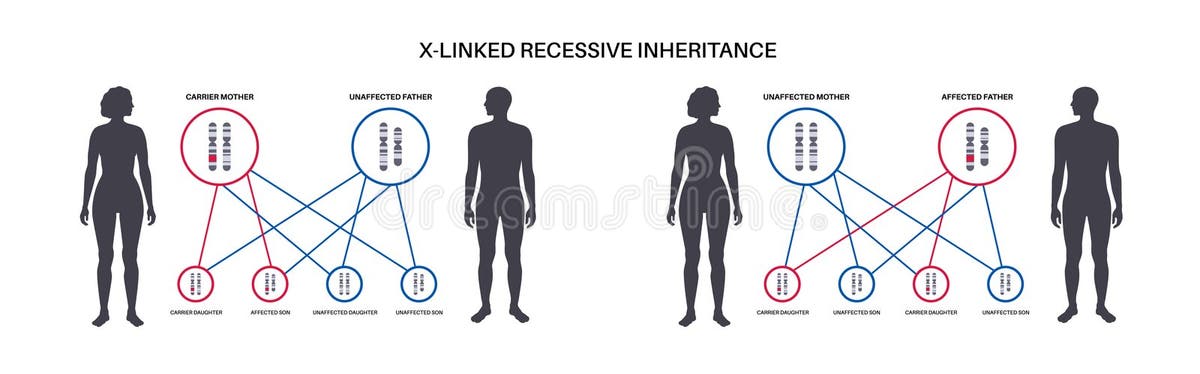 X Linked Inheritance Stock Illustrations – 42 X Linked Inheritance ...