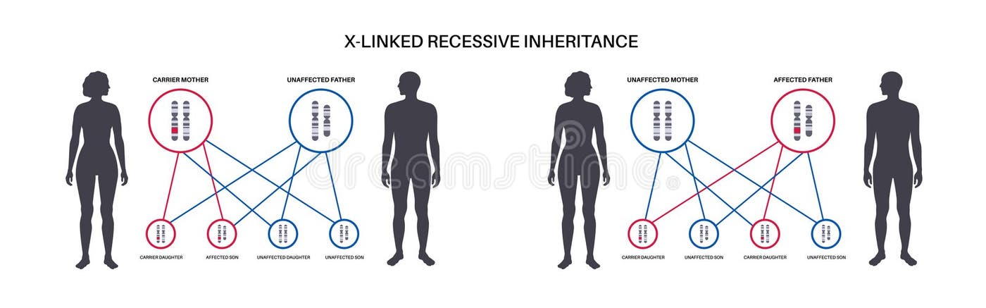 X Linked Inheritance Stock Illustrations – 42 X Linked Inheritance ...