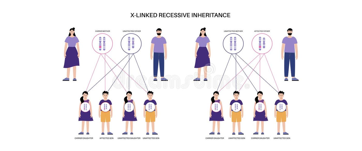 X Linked Inheritance Stock Illustrations – 51 X Linked Inheritance ...