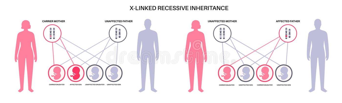 X Linked Inheritance Stock Illustrations – 51 X Linked Inheritance ...