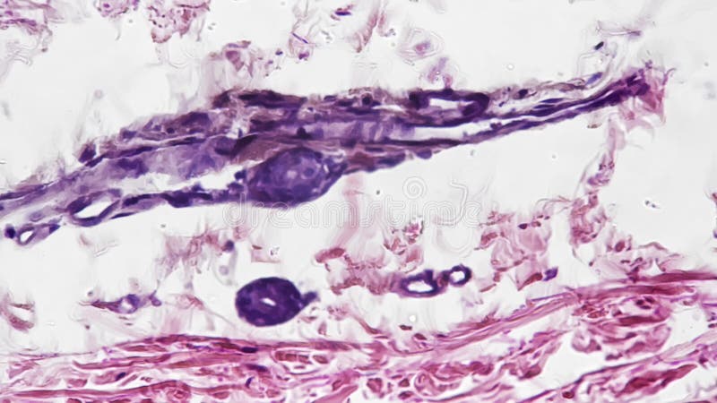 400x Magnification of Simple Squamous Epithelium Filmed Under ...