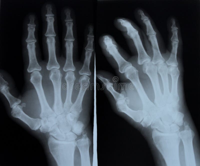 X-ray stock image. Image of body, people, radiological - 492893