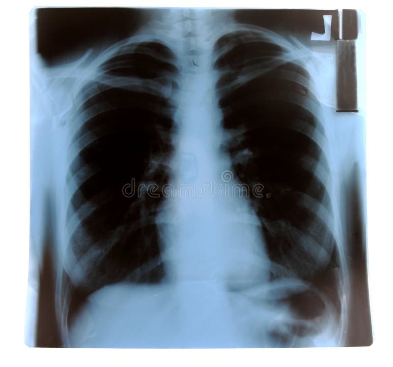 X-Ray stock image. Image of medical, human, health, technique - 28754529