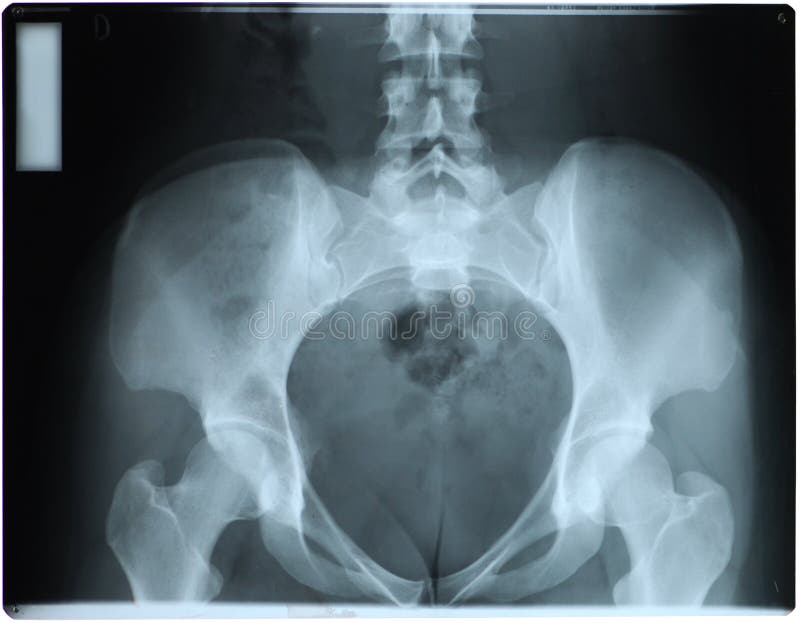 X-RAY stock image. Image of doctor, cage, film, sick, parts - 3985443