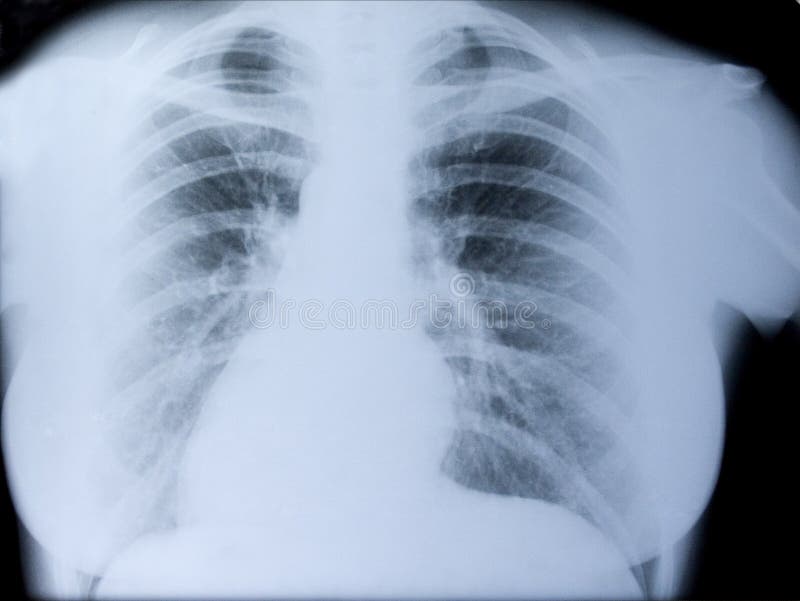 Color X-ray Art, Child 1 stock image. Image of hospital - 123023