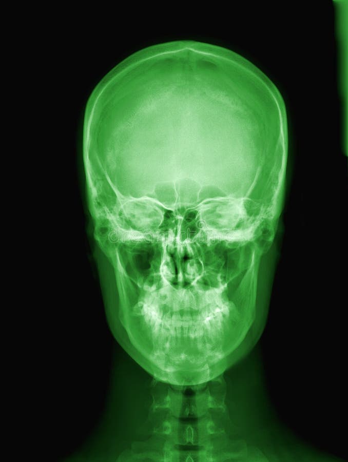 X-ray of Alien s skull. stock image. Image of space, bone - 19609325