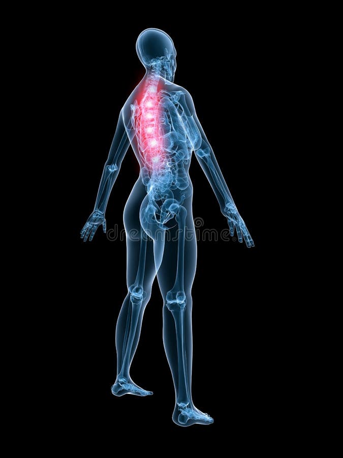X-ray anatomy backache stock illustration. Illustration of painful ...