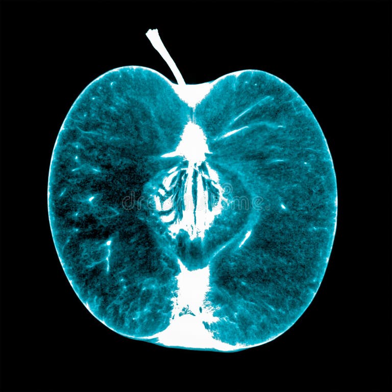 X-ray of the apple stock photo. Image of meal, food, fruit - 19649960