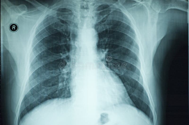 X ray body parts stock image. Image of physician, medication - 774321