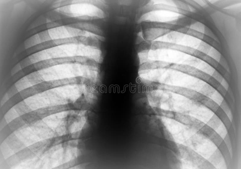 X ray body parts stock image. Image of pillar, doctor, health - 774345
