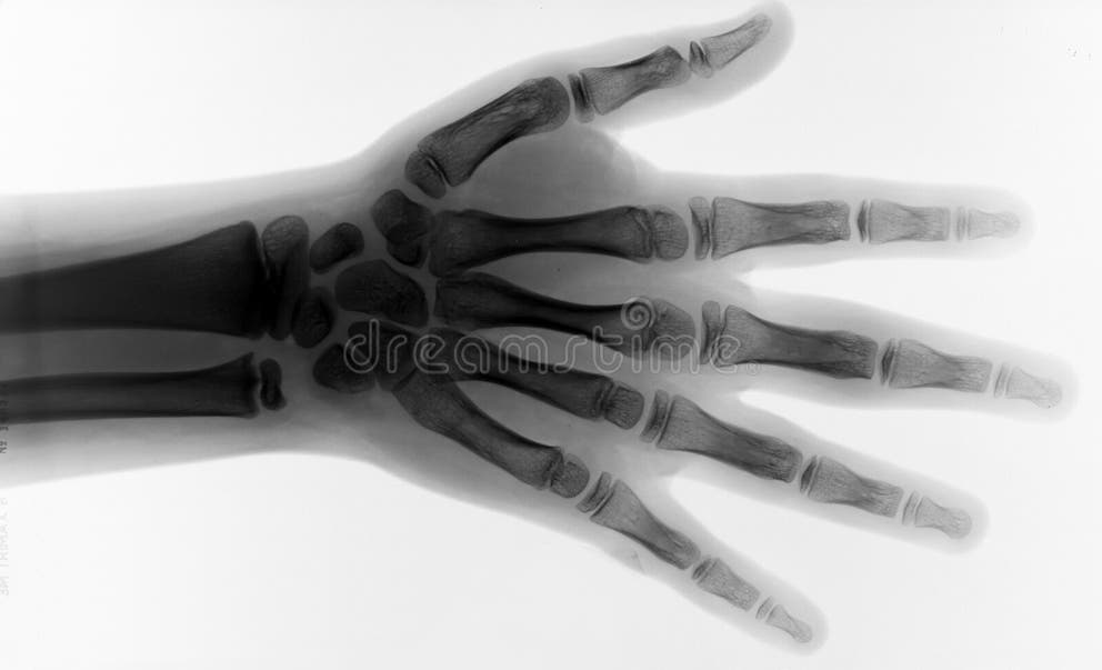 X ray body parts stock image. Image of health, examination - 774363
