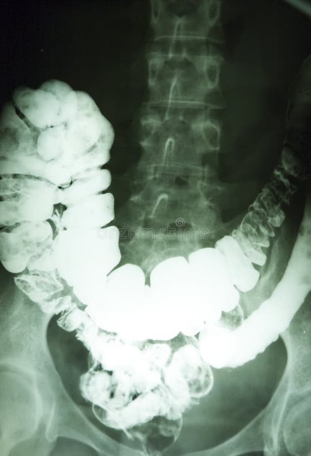 X ray body parts stock image. Image of pillar, doctor, health - 774345