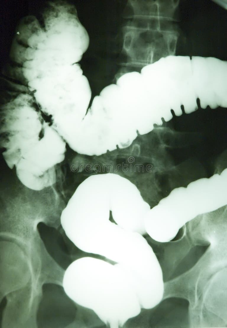 110 Lungs Parts Stock Photos - Free & Royalty-Free Stock Photos from ...