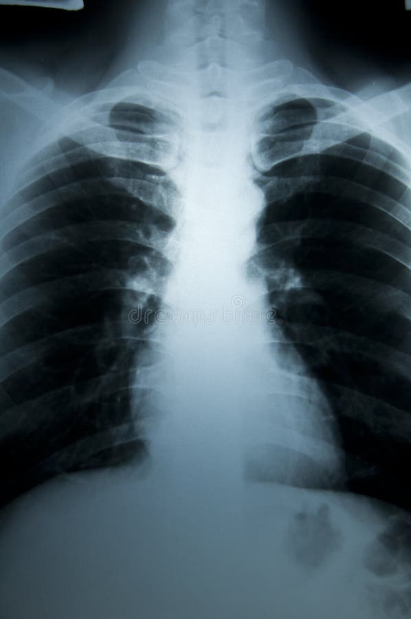 X-Ray body scan stock image. Image of health, abdomen - 30443623