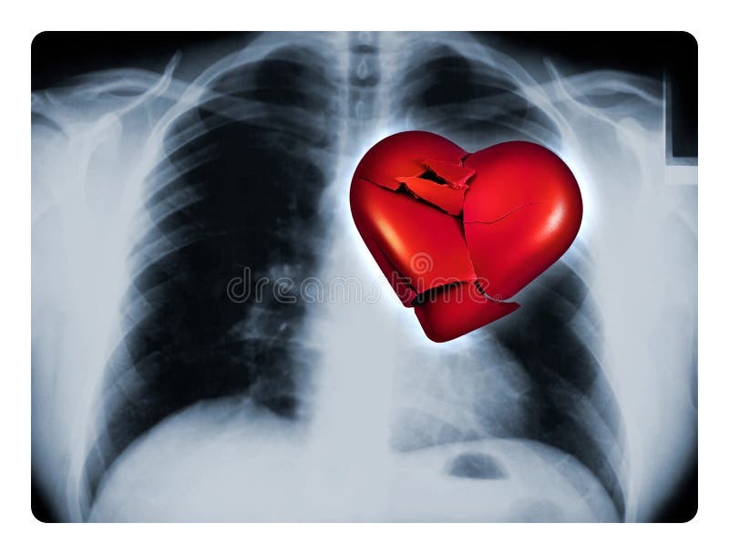 Broken Heart Ray Background The Broken Hearted Are The Bravest Among